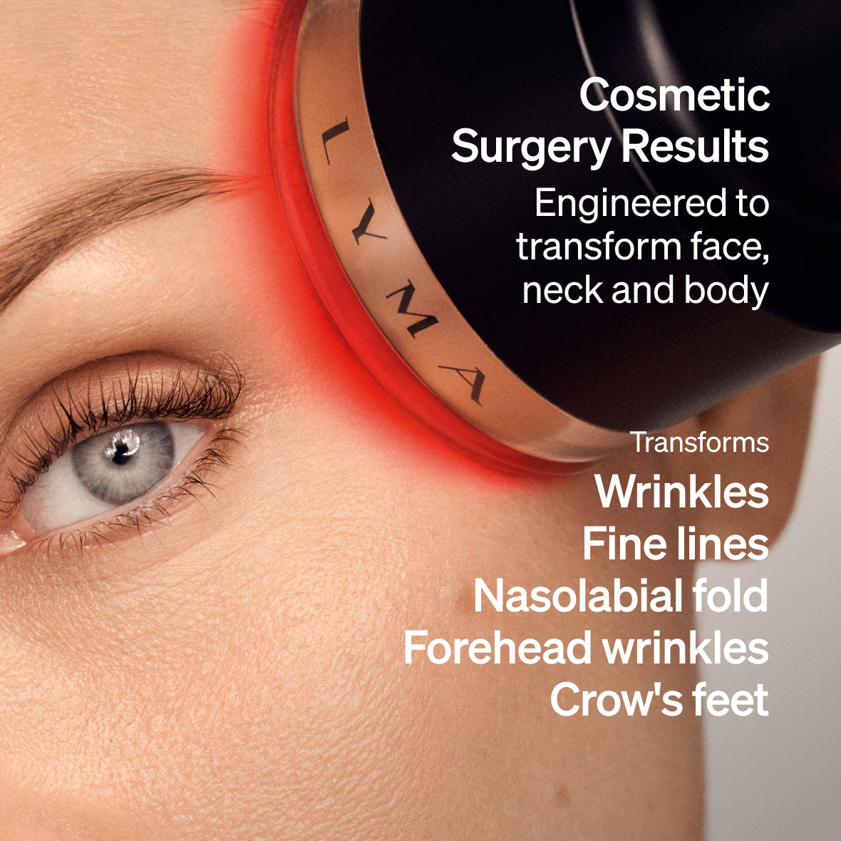 Shop The LYMA Laser PRO Today – LYMA USA